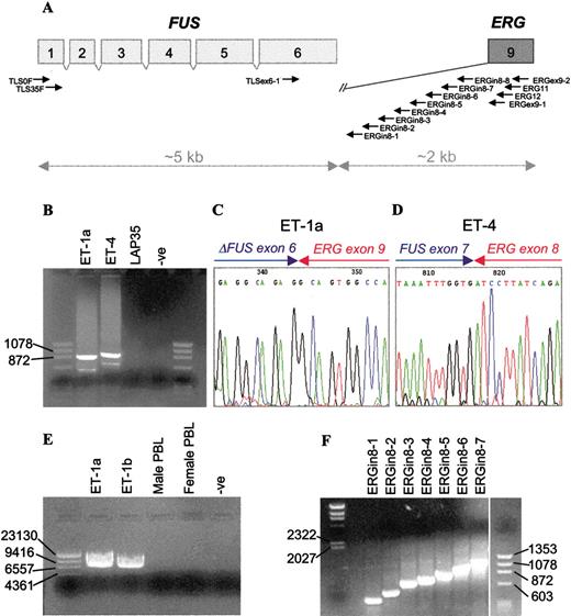 FUS/ERG Gene Fusions in Ewing’s Tumors | Cancer Research | American ...
