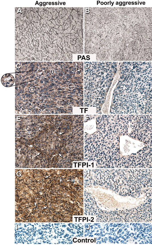 Differential Role of Tissue Factor Pathway Inhibitors 1 and 2 in ...