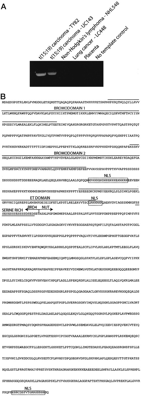BRD4-NUT Fusion Oncogene | Cancer Research | American Association for ...