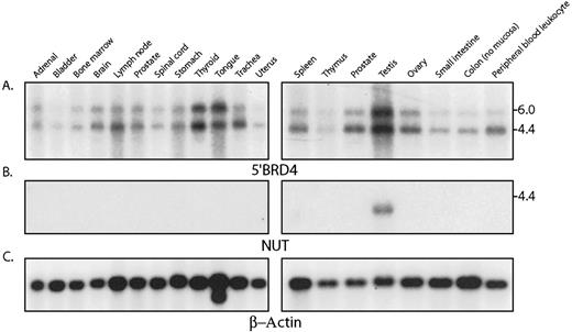 BRD4-NUT Fusion Oncogene | Cancer Research | American Association for ...