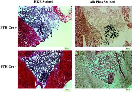 Parathyroid Gland-specific Deletion of the Mouse Men1 Gene Results in ...
