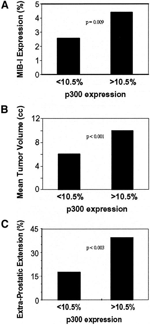 p300 in Prostate Cancer Proliferation and Progression | Cancer Research ...