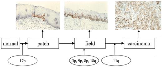 A Genetic Explanation of Slaughter’s Concept of Field Cancerization ...