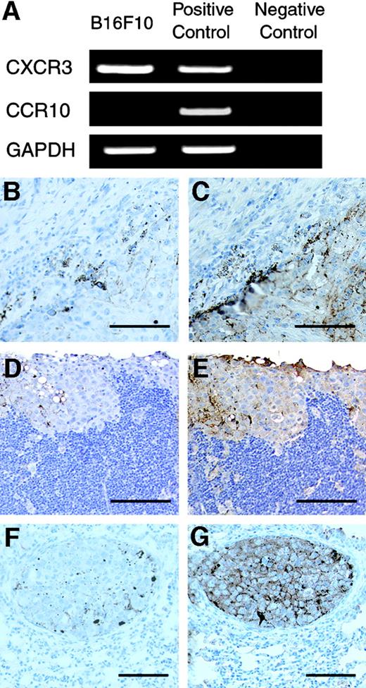 Pivotal Role of CXCR3 in Melanoma Cell Metastasis to Lymph Nodes ...