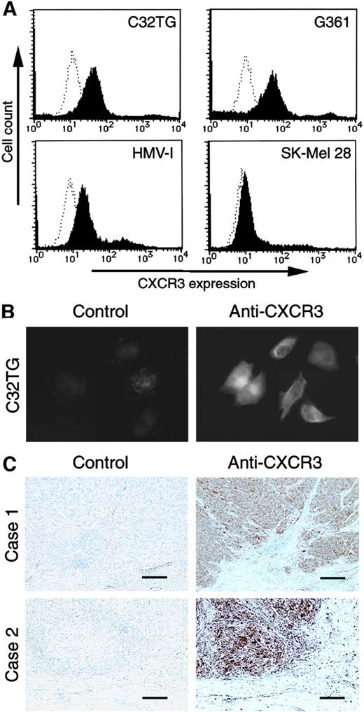 Pivotal Role of CXCR3 in Melanoma Cell Metastasis to Lymph Nodes ...