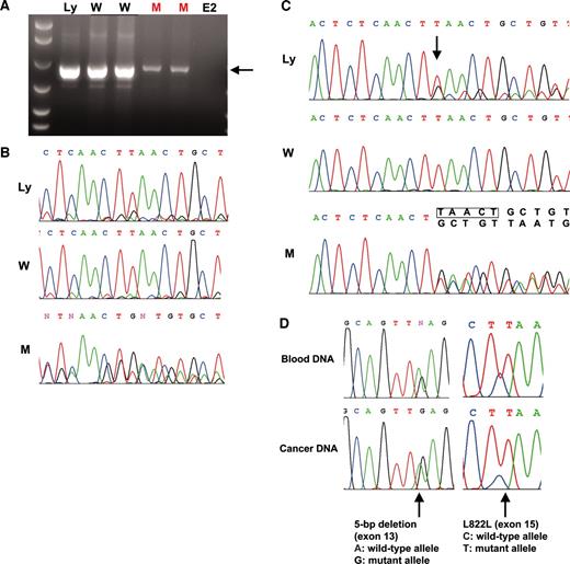 Mismatch Repair Gene PMS2 | Cancer Research | American Association for ...