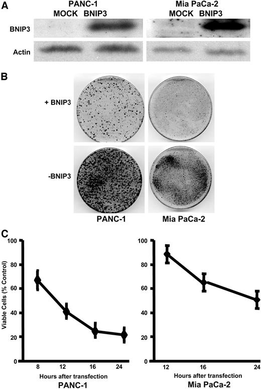 Silencing of the Hypoxia-Inducible Cell Death Protein BNIP3 in ...