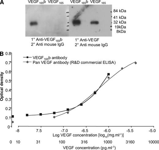 VEGF165b, an Inhibitory Vascular Endothelial Growth Factor Splice ...