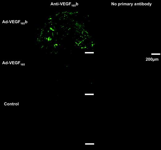 VEGF165b, an Inhibitory Vascular Endothelial Growth Factor Splice ...
