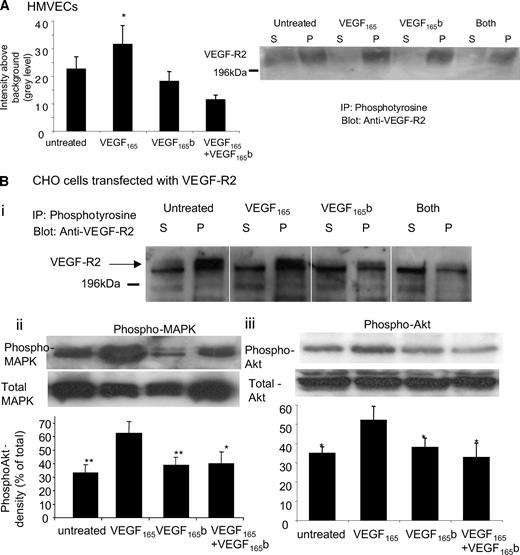 VEGF165b, an Inhibitory Vascular Endothelial Growth Factor Splice ...