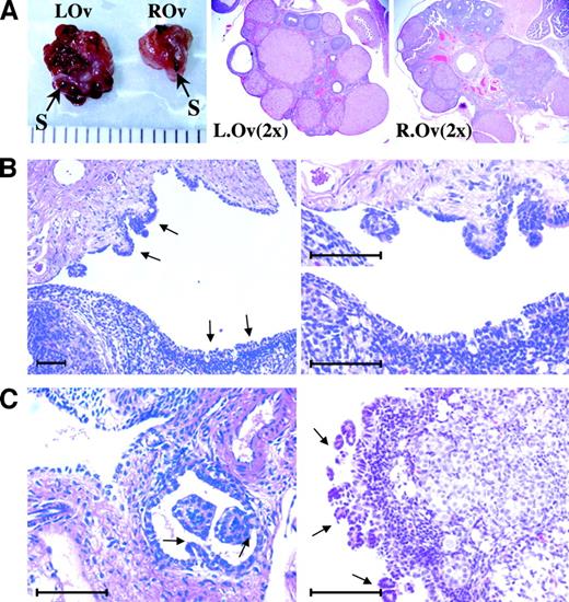 Characterization of a Carcinogenesis Rat Model of Ovarian Preneoplasia ...