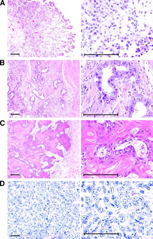 Characterization of a Carcinogenesis Rat Model of Ovarian Preneoplasia ...