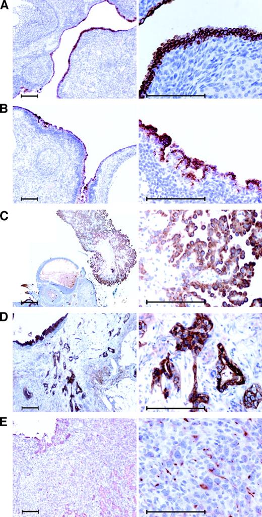 Characterization of a Carcinogenesis Rat Model of Ovarian Preneoplasia ...