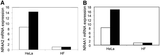 Nuclear Hormone Receptor NR4A2 Is Involved in Cell Transformation and ...