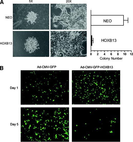 HOXB13 Induces Growth Suppression of Prostate Cancer Cells as a ...