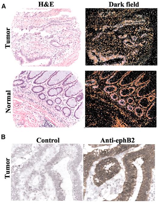 EphB2 as a Therapeutic Antibody Drug Target for the Treatment of ...