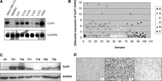 Cyr61 Is Overexpressed in Gliomas and Involved in Integrin-Linked ...