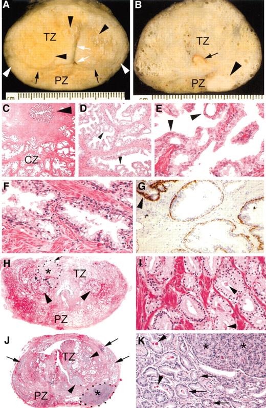 Prostate Pathology of Genetically Engineered Mice: Definitions and ...