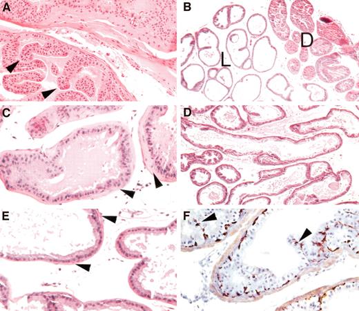 Prostate Pathology of Genetically Engineered Mice: Definitions and ...