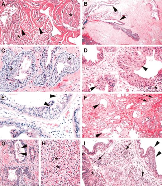 Prostate Pathology of Genetically Engineered Mice: Definitions and ...