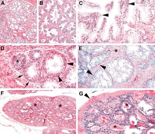 Prostate Pathology of Genetically Engineered Mice: Definitions and ...