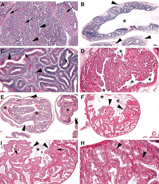 Prostate Pathology of Genetically Engineered Mice: Definitions and ...