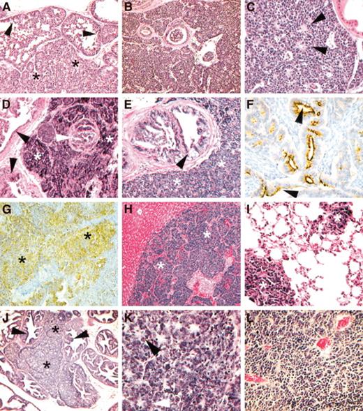 Prostate Pathology of Genetically Engineered Mice: Definitions and ...