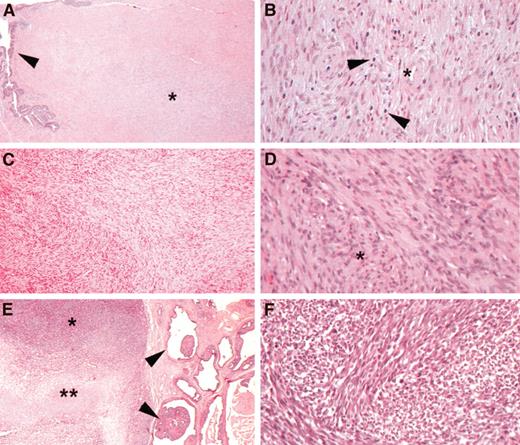 Prostate Pathology of Genetically Engineered Mice: Definitions and ...