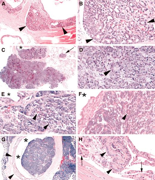 Prostate Pathology of Genetically Engineered Mice: Definitions and ...