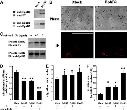 The Phosphorylation of EphB2 Receptor Regulates Migration and Invasion ...