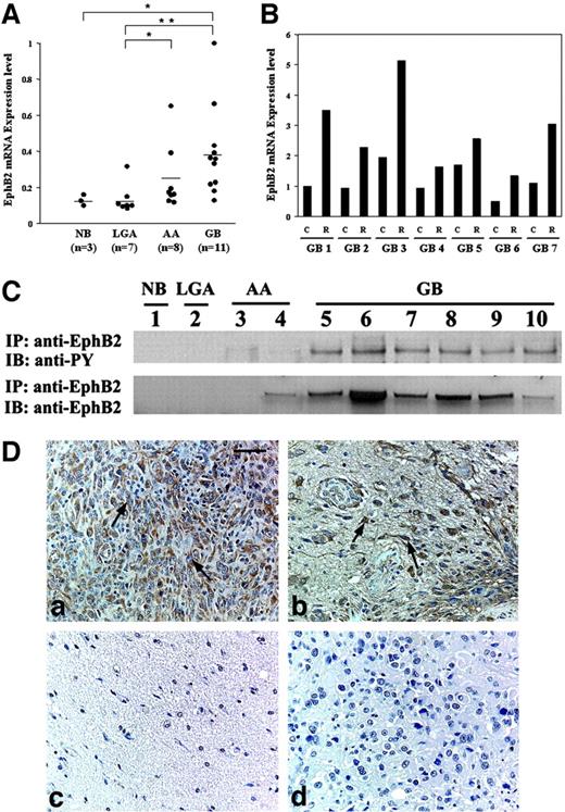 The Phosphorylation of EphB2 Receptor Regulates Migration and Invasion ...