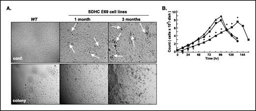 A Mutation in the SDHC Gene of Complex II Increases Oxidative Stress ...