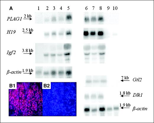 Salivary Gland Tumors in Transgenic Mice with Targeted PLAG1 Proto ...