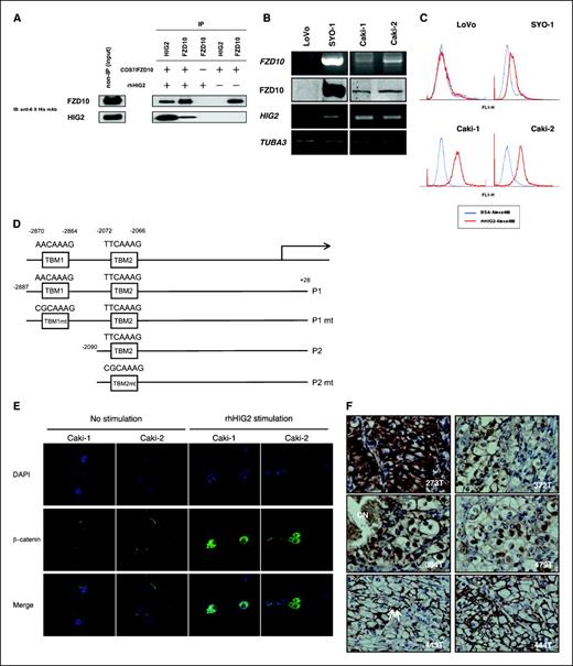 Hypoxia-Inducible Protein 2 (HIG2), a Novel Diagnostic Marker for Renal ...