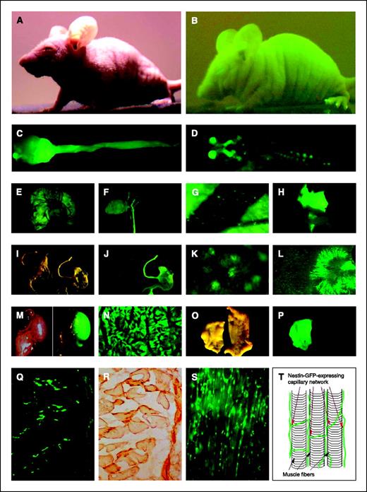 Nestin-Linked Green Fluorescent Protein Transgenic Nude Mouse for ...