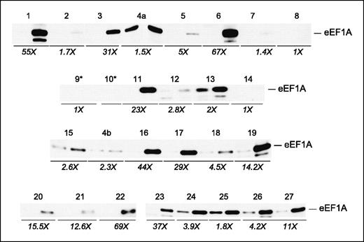 Increased Proteasome Activity, Ubiquitin-Conjugating Enzymes, and eEF1A ...