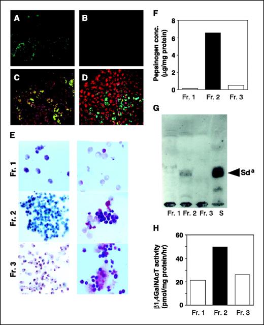 Introduction of Sda Carbohydrate Antigen in Gastrointestinal Cancer ...