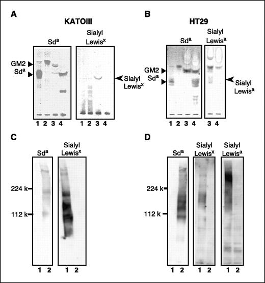 Introduction of Sda Carbohydrate Antigen in Gastrointestinal Cancer ...