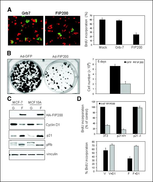 Mechanism of Cell Cycle Regulation by FIP200 in Human Breast Cancer ...