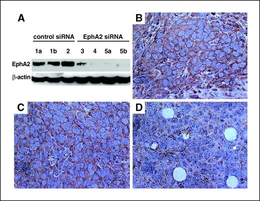 Therapeutic EphA2 Gene Targeting In vivo Using Neutral Liposomal Small ...
