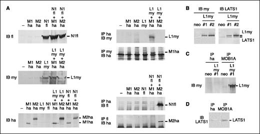 Human LATS1 Is a Mitotic Exit Network Kinase | Cancer Research ...