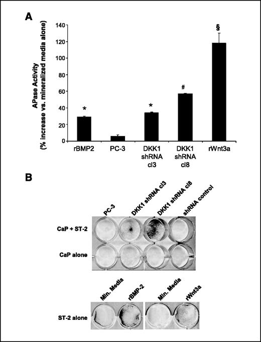 Prostate Cancer Cells Promote Osteoblastic Bone Metastases through Wnts ...