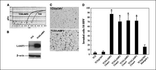 Overexpression of LAMP3/TSC403/DC-LAMP Promotes Metastasis in Uterine ...