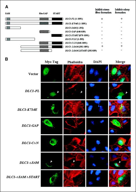Rho GTPase-Activating Protein Deleted in Liver Cancer Suppresses Cell ...