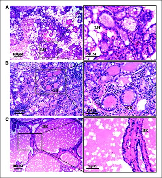 Epimorphin Overexpression in the Mouse Mammary Gland Promotes Alveolar ...