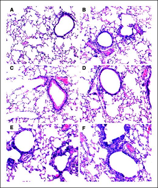 Asbestos-Induced Lung Inflammation and Epithelial Cell Proliferation ...