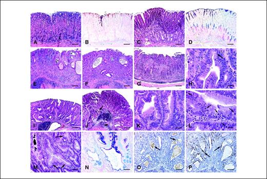 Helicobacter pylori but not High Salt Induces Gastric Intraepithelial ...