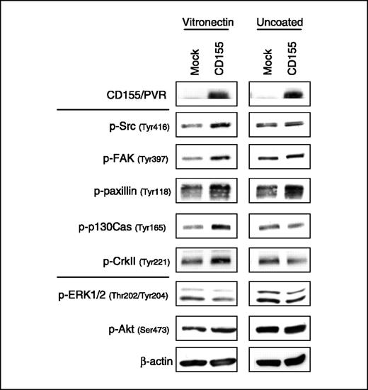 CD155/PVR Enhances Glioma Cell Dispersal by Regulating Adhesion ...