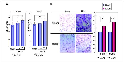 ANLN Plays a Critical Role in Human Lung Carcinogenesis through the ...
