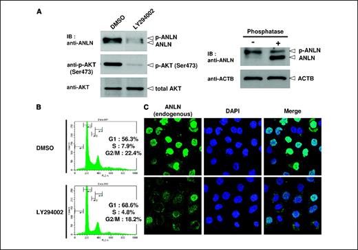 ANLN Plays a Critical Role in Human Lung Carcinogenesis through the ...
